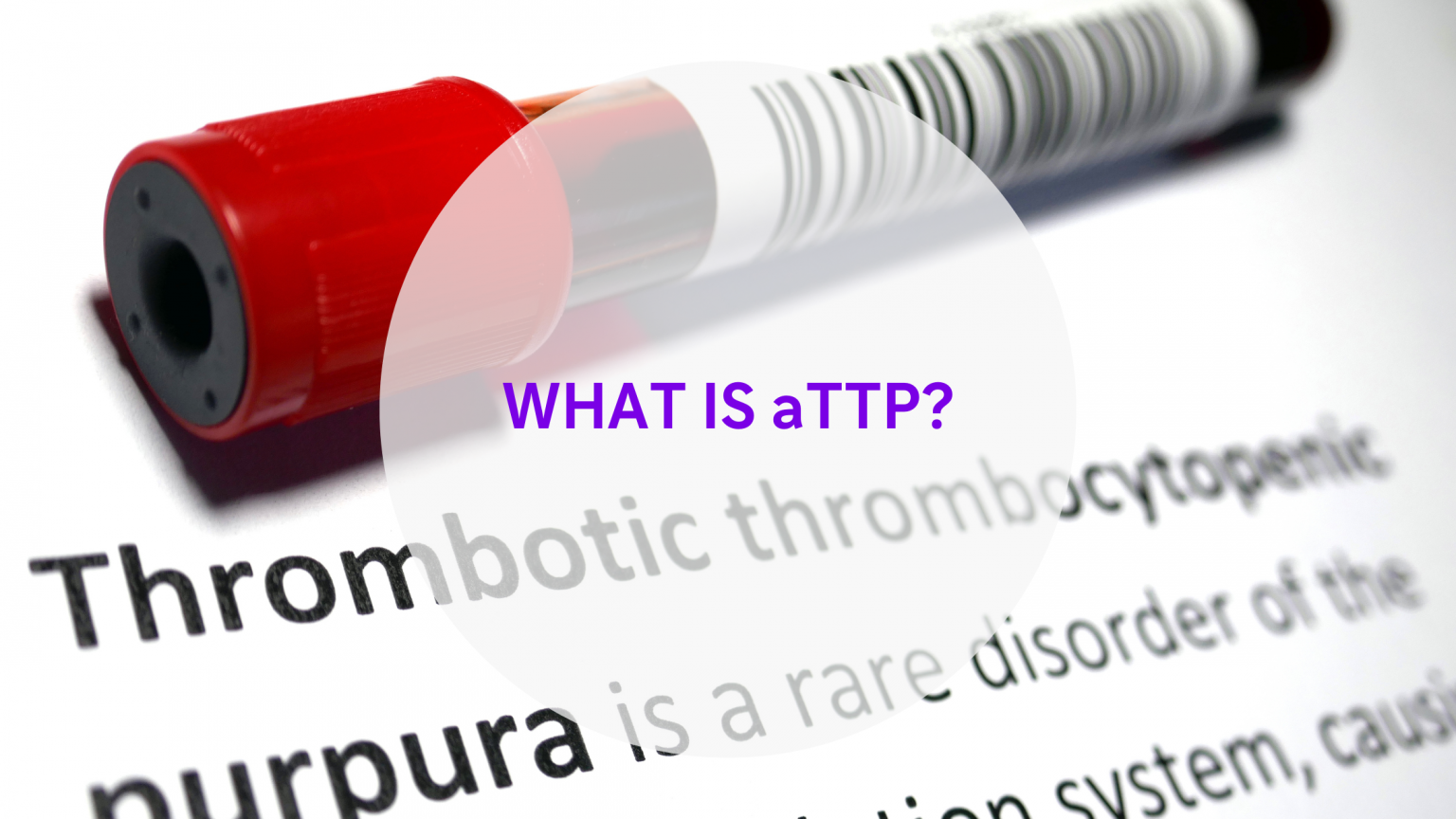 acquired Thrombotic Thrombocytopenic Purpura